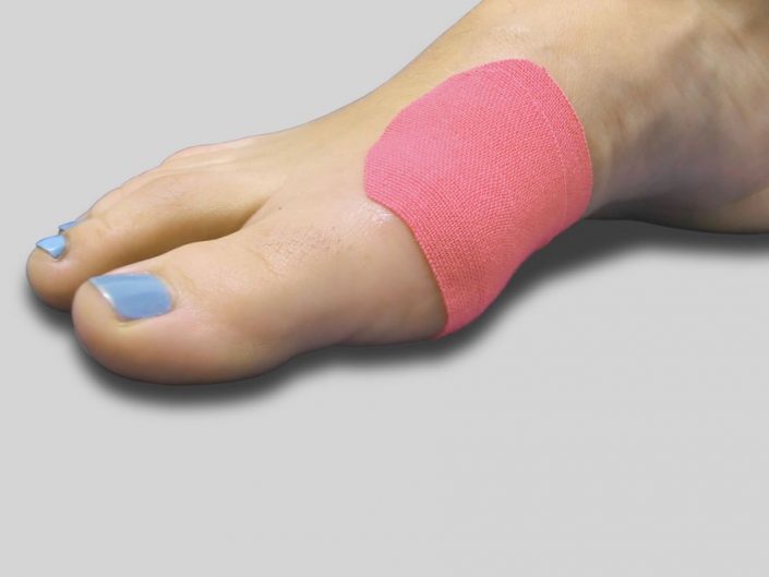 Hallux valgus - Fuß-Schule München - Die Kunst des Gehens